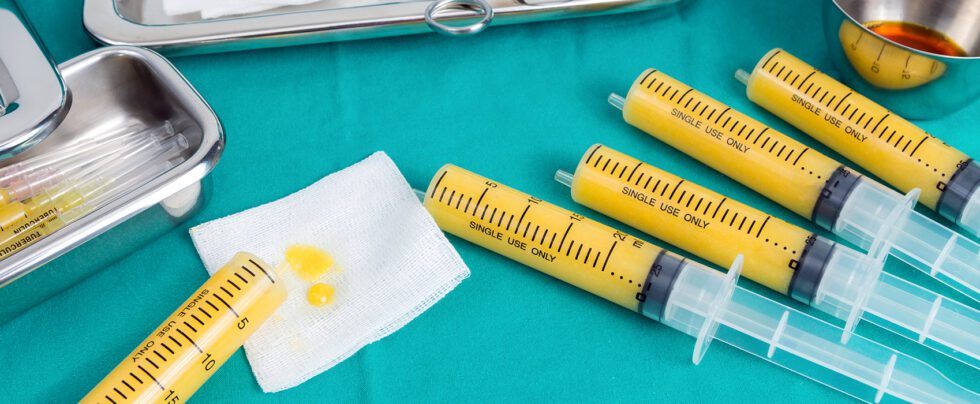 Le Meilleur Lipofilling Visage à Paris : Rajeunir Le Visage Naturellement